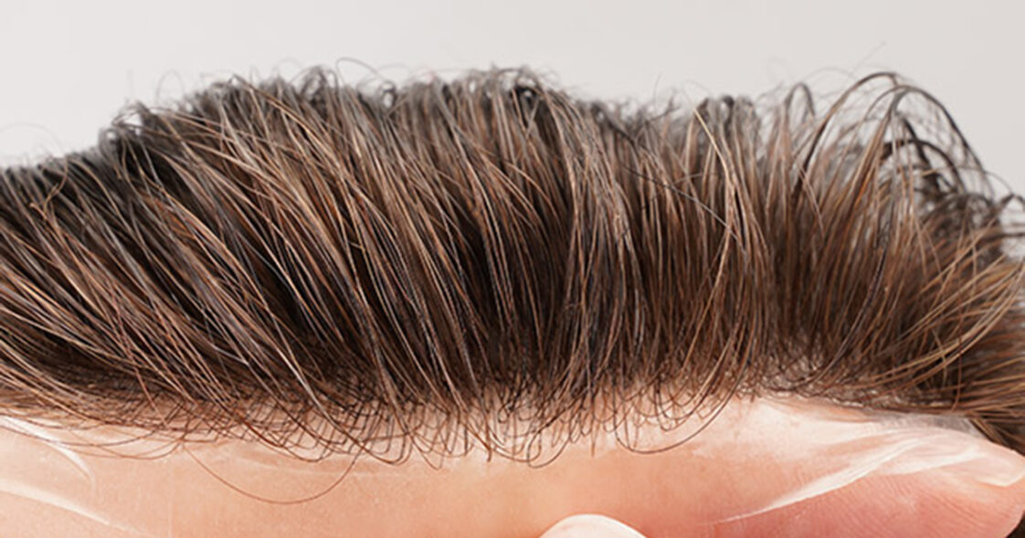 Receding Hairline Guide How To Stop Receding Hairline Virascoop